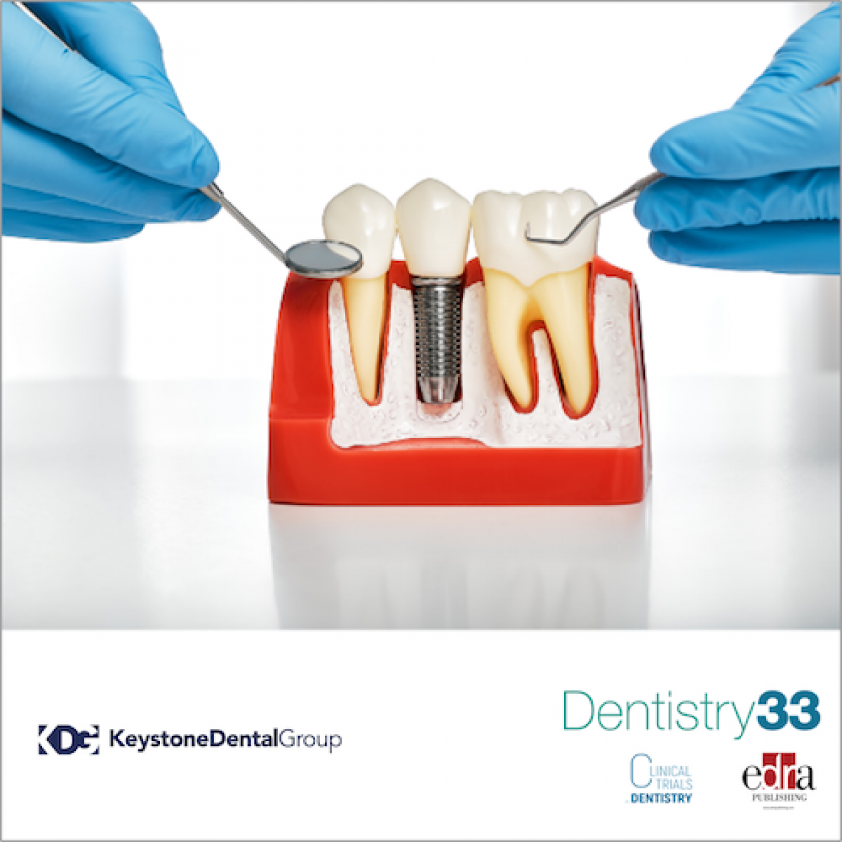 Keystone Dental closes $25M financing for dental implant | Dentistry33