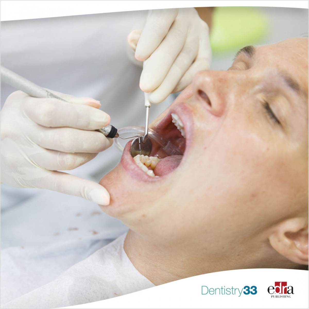 Obesity as a risk factor for periodontitis | Dentistry33